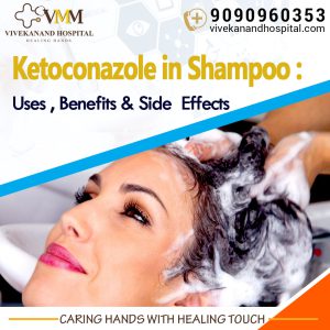 Ketoconazole in Shampoo: Uses, Benefits & Side Effects | Vivekanand ...